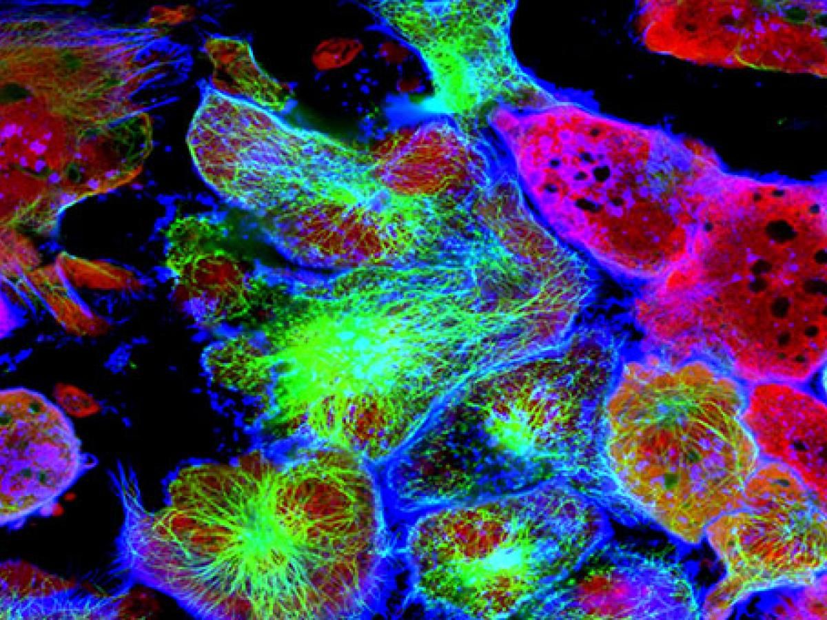 Our articles | Cancer Research Horizons